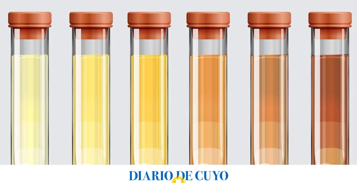 Qué significa el color de mi orina y cuándo debo preocuparme | Diario ...