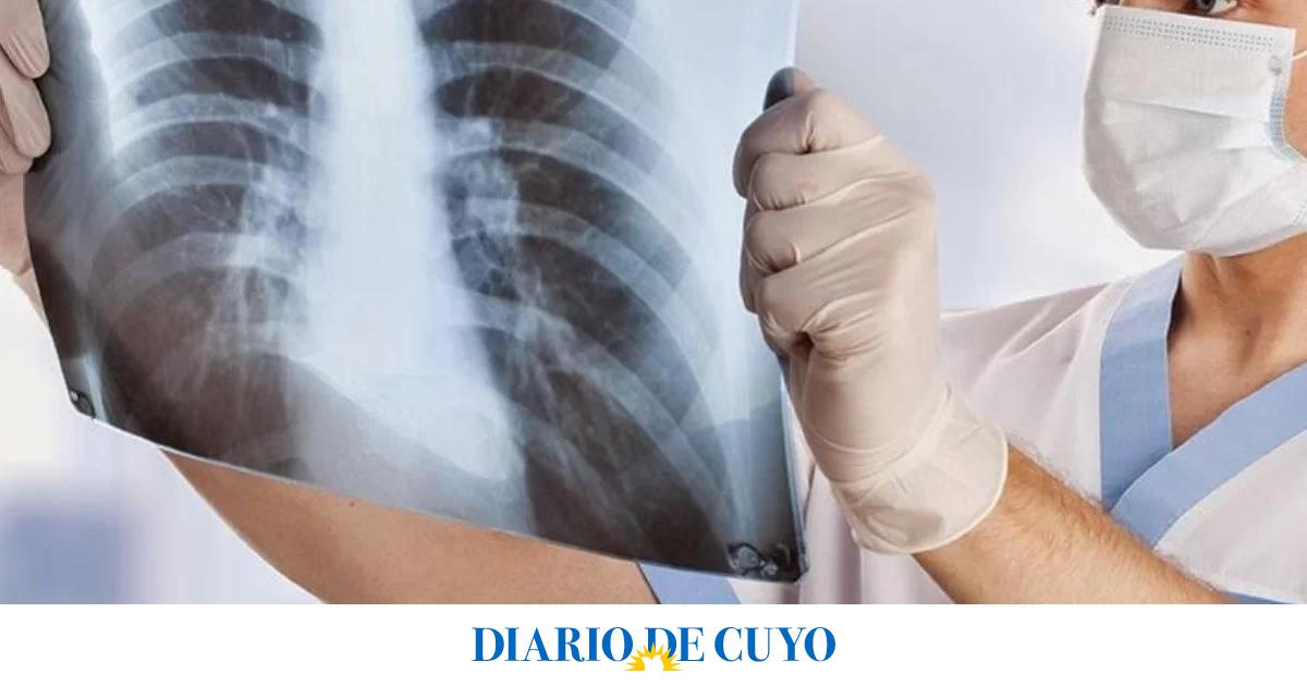 Día Nacional del Técnico Radiólogo | Diario de Cuyo