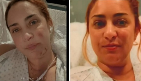 Impactante: así quedó el rostro de María Julián Olivan tras el ...